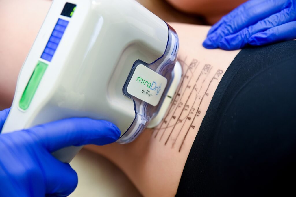 6 Benefits of miraDry Treatment - Jaxtr